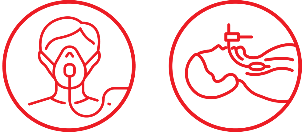 Airon Corporation - MRI Compatible Ventilators